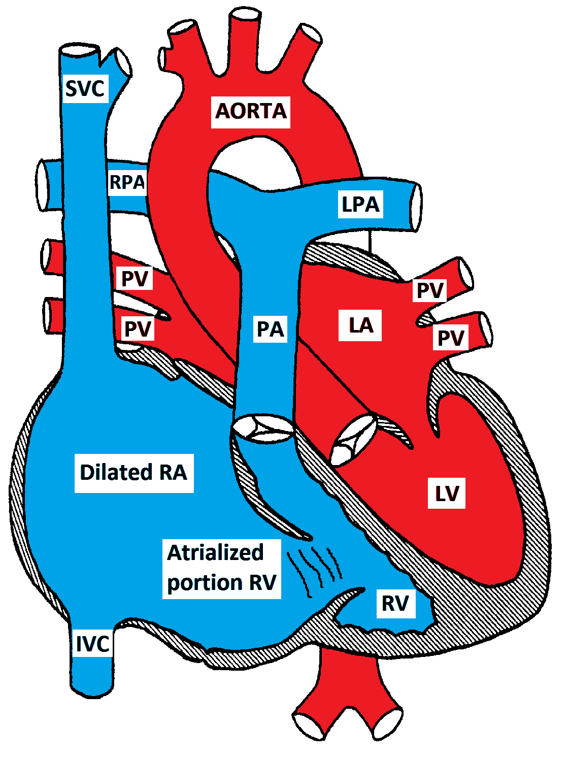Pediatric Cardiology