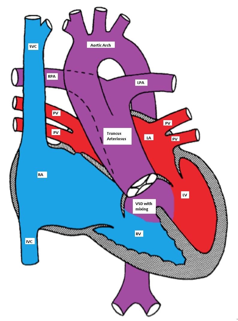 Cyanotic Cardiac Lesions