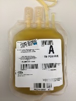 Plasma