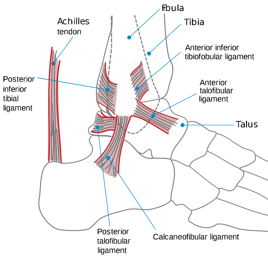 Sprains